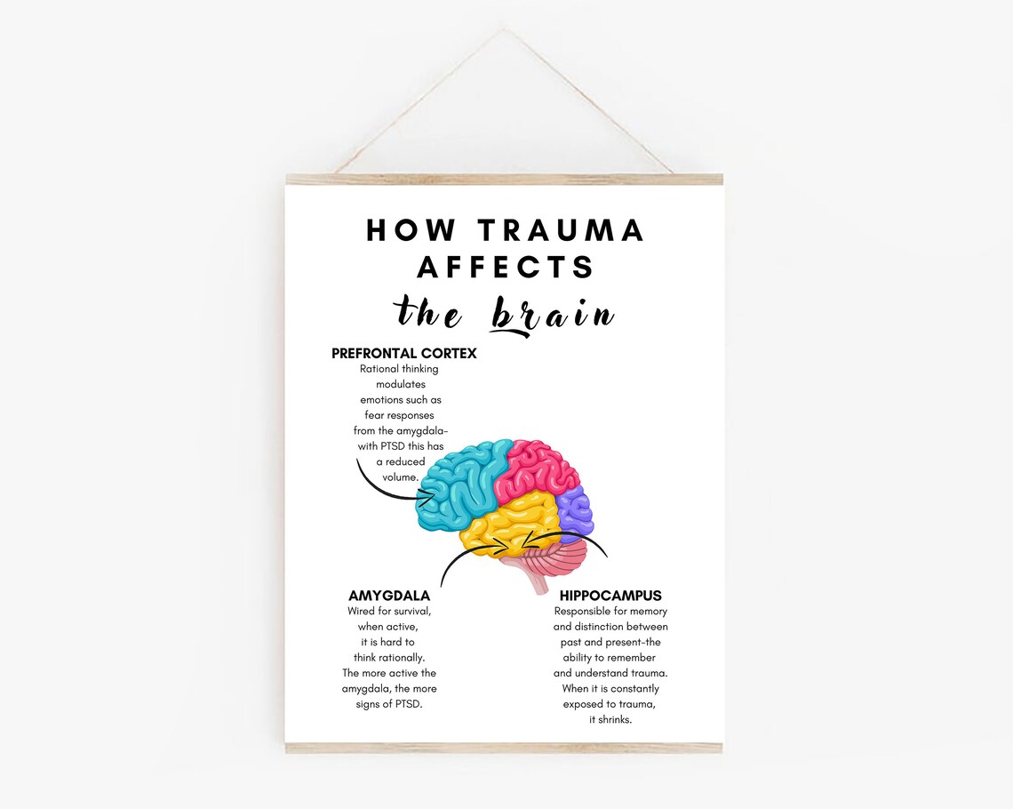 How Trauma Affects the Brain Poster Therapy Office Decordbt - Etsy