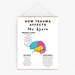 How Trauma Affects the Brain Poster, Therapy Office Decor,dbt Prints ...