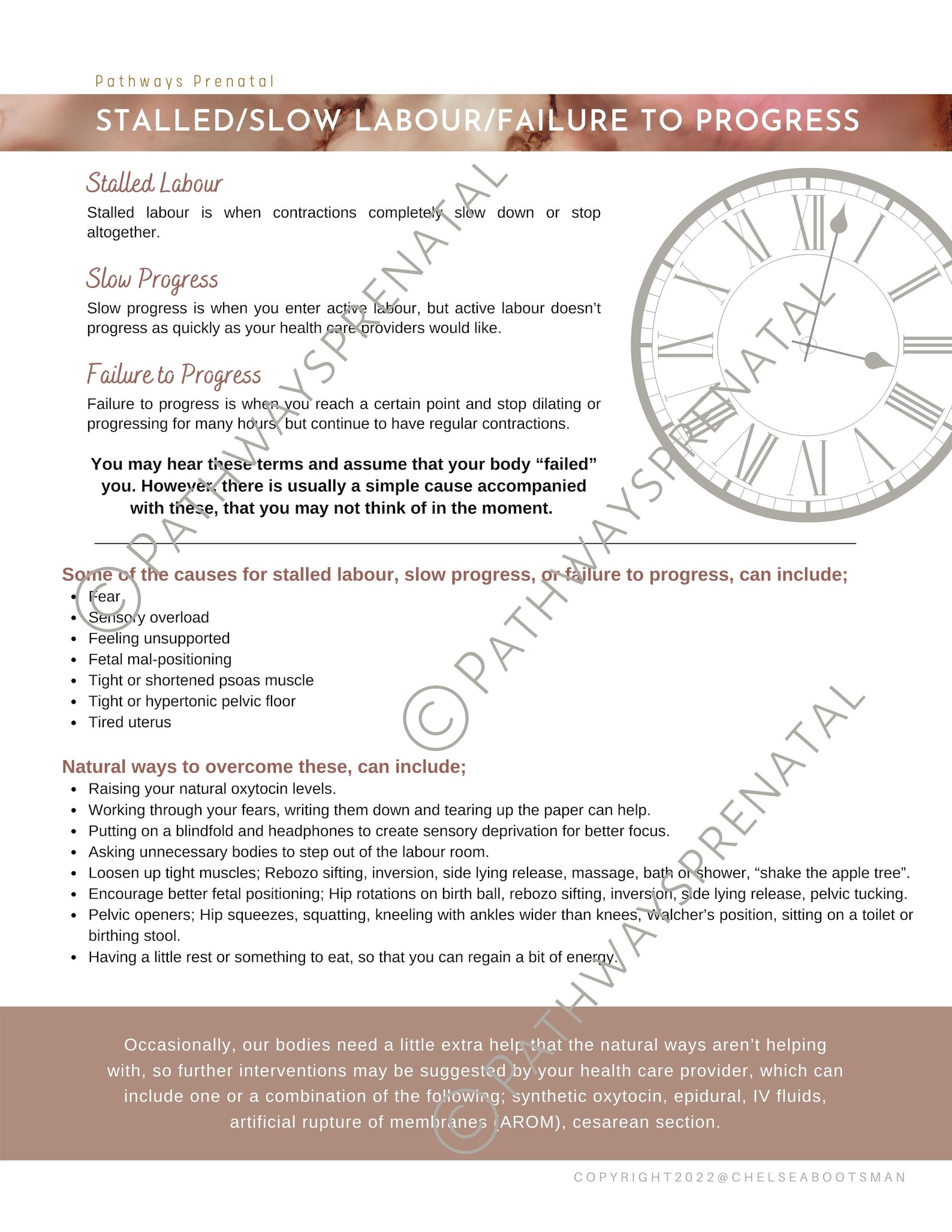 Failure to Progress Labour Handout, Birth Doula Resource (JPEG) - Etsy UK