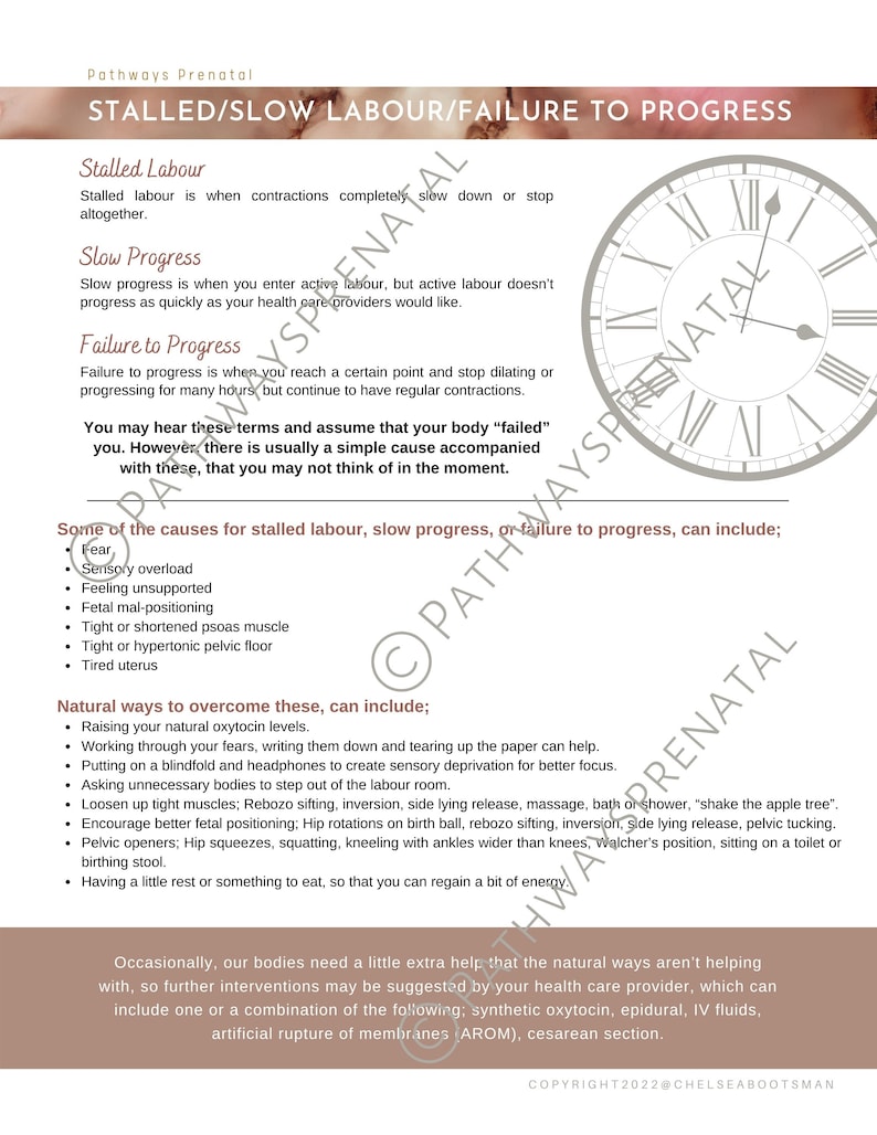 Failure to Progress Labour Handout, Birth Doula Resource (JPEG) - Etsy