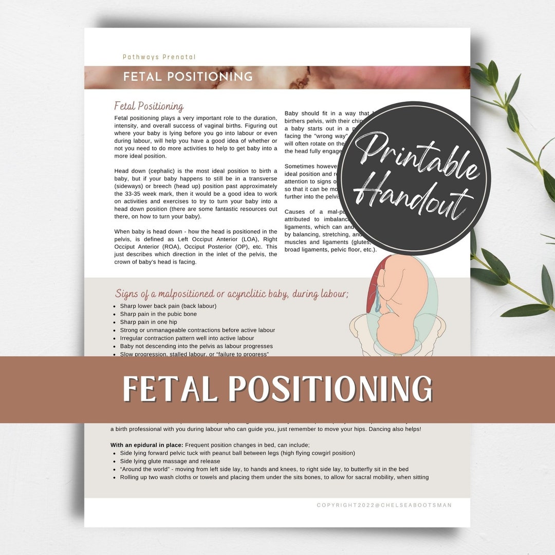 Fetal Positioning, Birth Prep Printable Handout for Pregnant Women ...