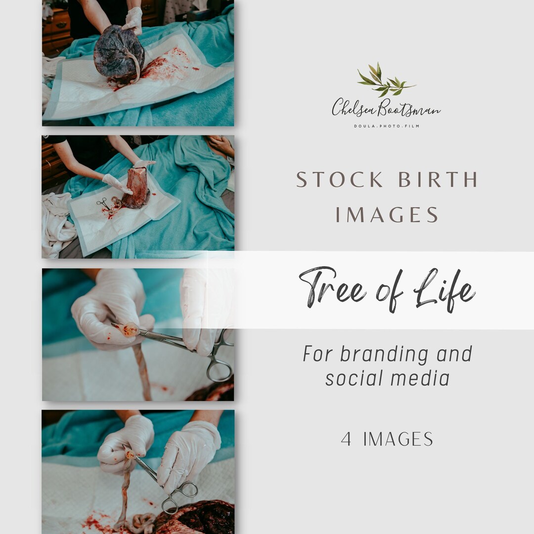 Placenta Bundle 3 Stock Birth Photography. Image Licenses. Doula Tools ...