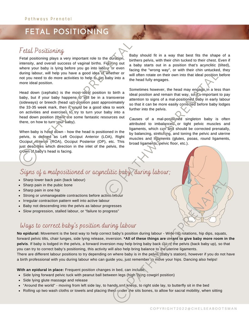 Fetal Positioning, Birth Prep Printable Handout for Pregnant Women ...