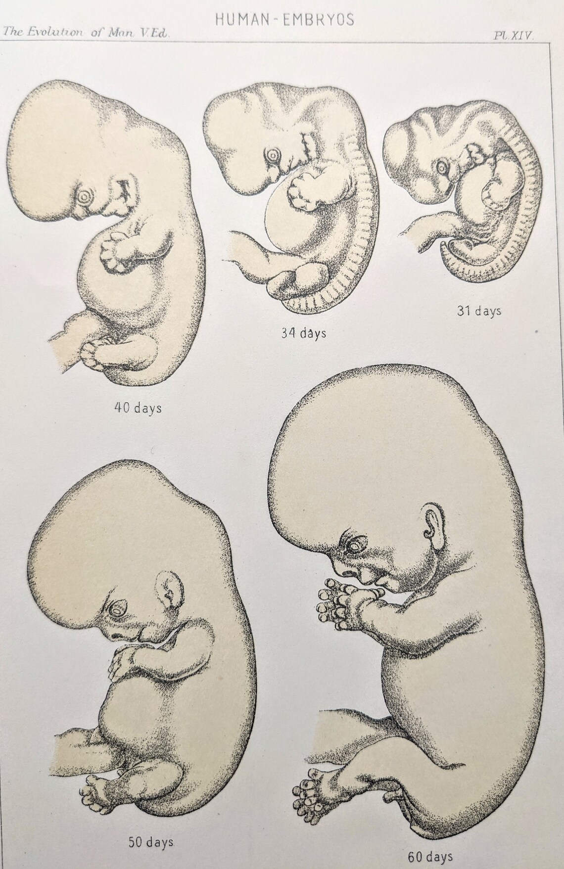1910 Ernst Haeckel Human Embryos From the Fourth to the Eighth - Etsy