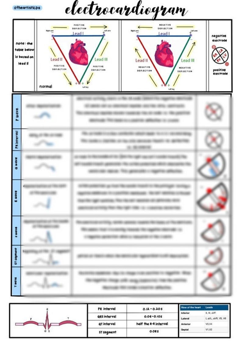 Normal ECG Lead II Breakdown - Etsy