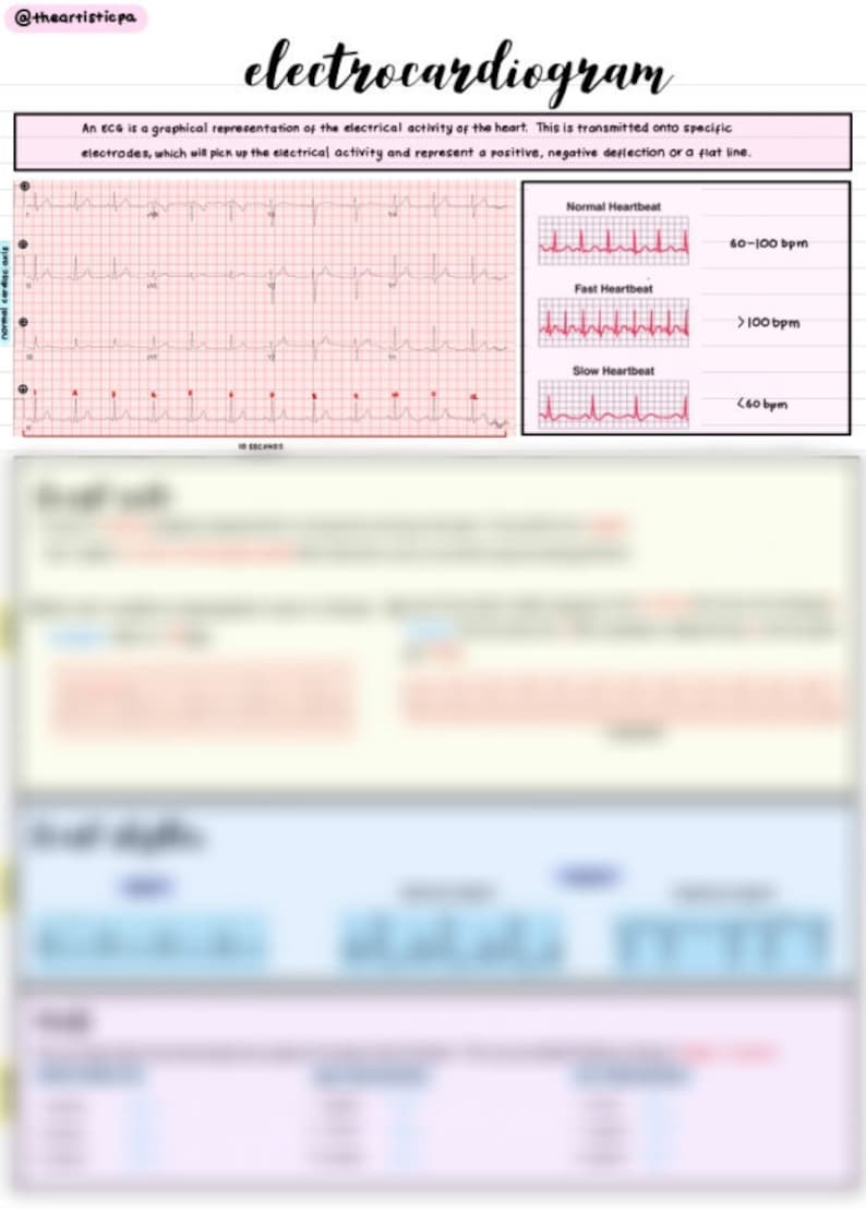 How to Interpret an ECG - Part 1 - Etsy