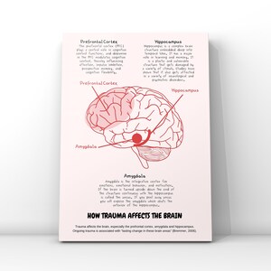 Trauma Brain Poster, Brain Anatomy for Trauma, Brain Wall Art Therapy ...