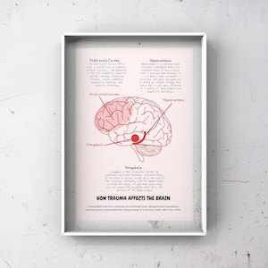 Trauma Brain Poster, Brain Anatomy for Trauma, Brain Wall Art Therapy ...