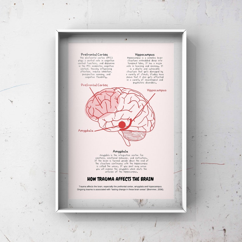 Trauma Brain Poster, Brain Anatomy for Trauma, Brain Wall Art Therapy ...