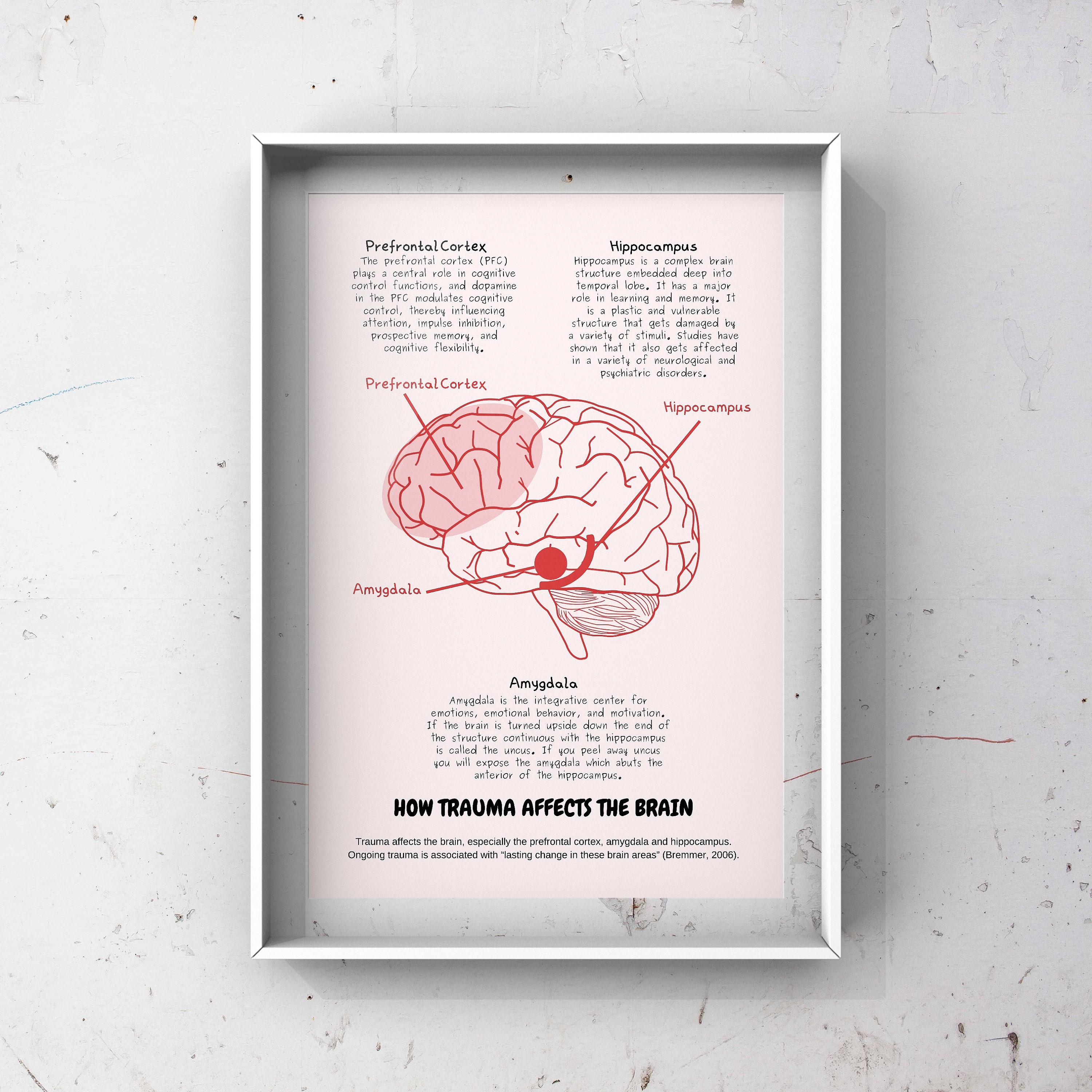 Trauma Brain Anatomy Poster: Therapy Office Decor (digital Files) - Etsy