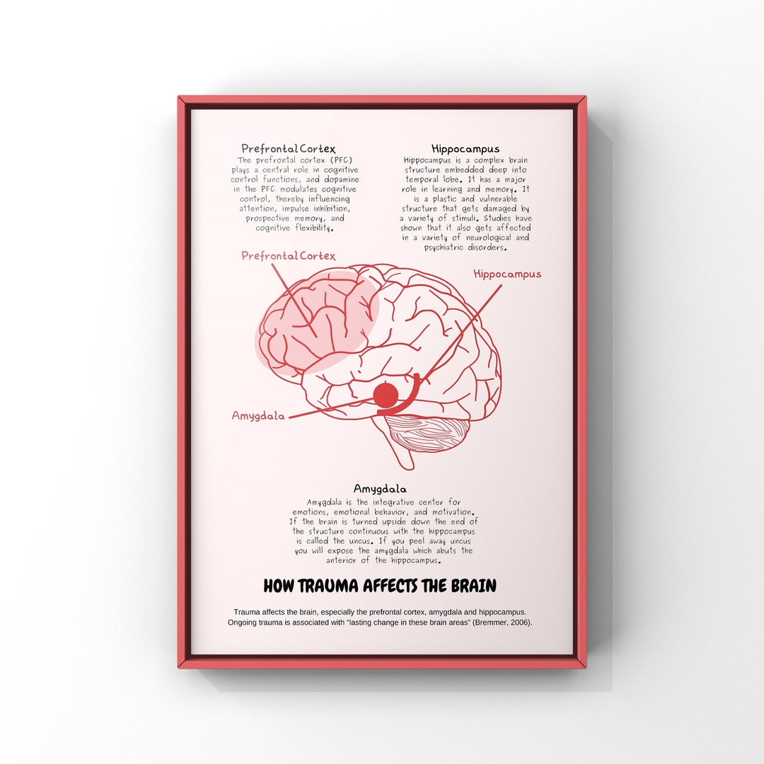 Trauma Brain Poster, Brain Anatomy for Trauma, Brain Wall Art Therapy ...