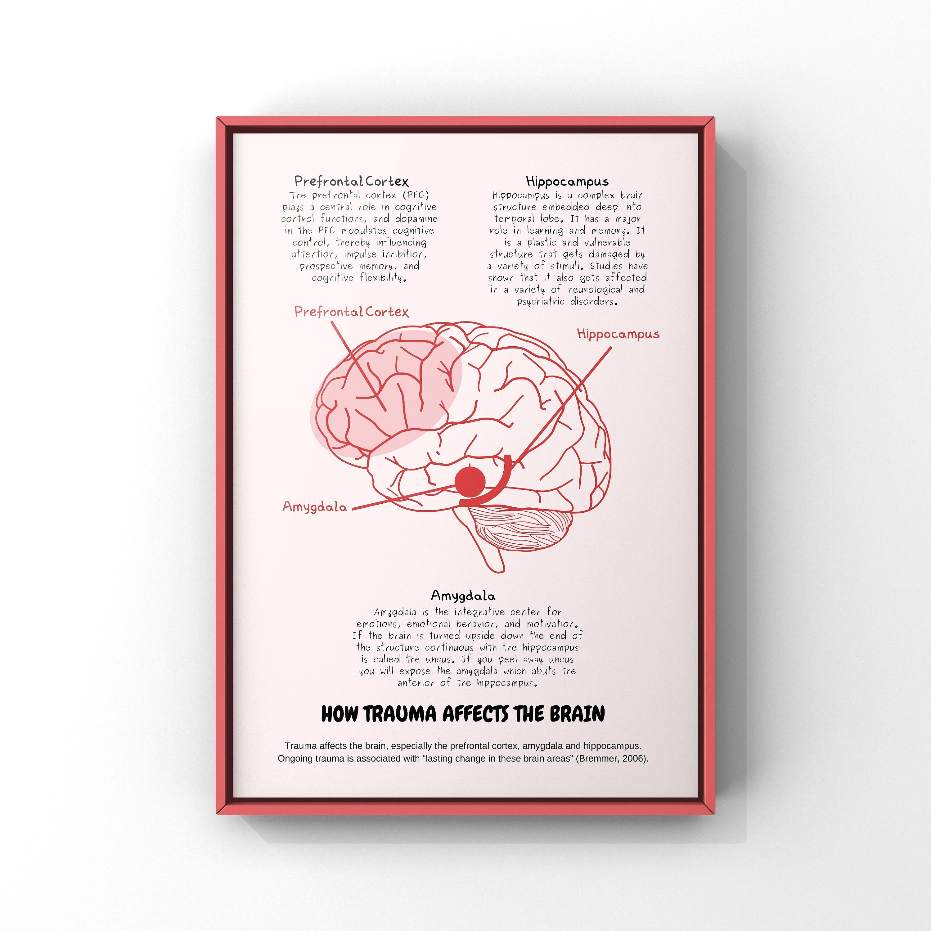 Trauma Brain Poster, Brain Anatomy for Trauma, Brain Wall Art Therapy ...