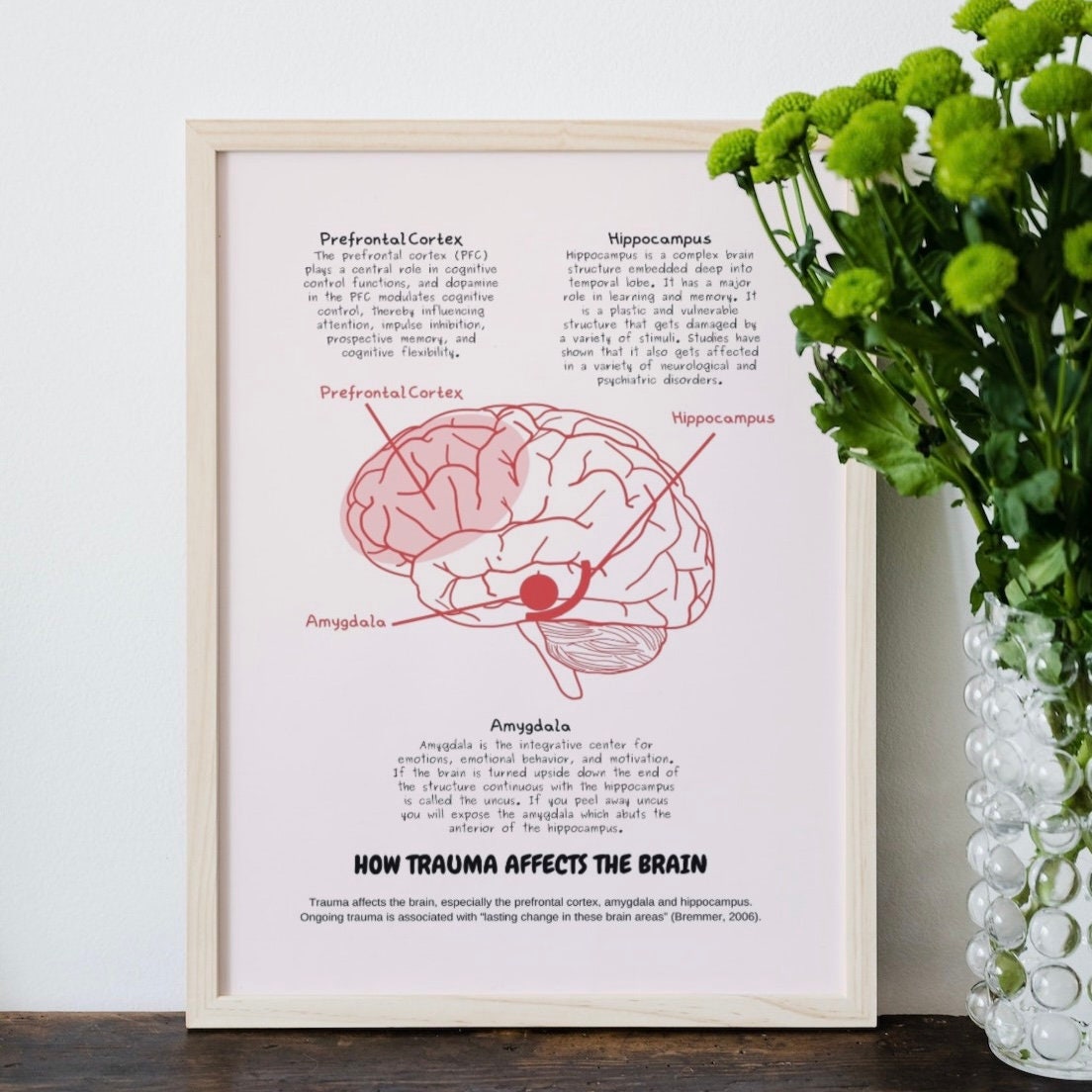 Trauma Brain Poster, Brain Anatomy for Trauma, Brain Wall Art Therapy ...
