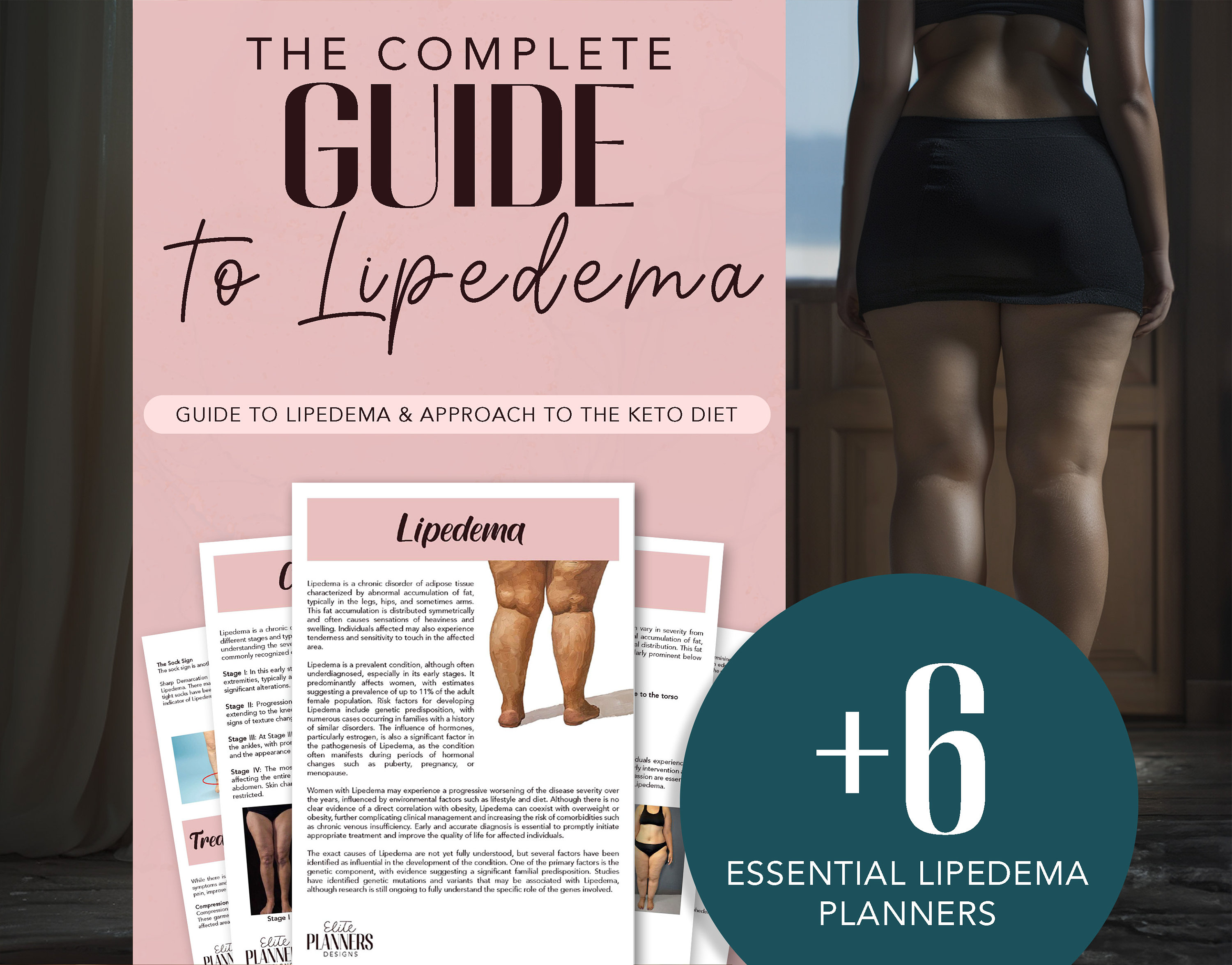 The Complete Guide to Lipedema: From Diagnosis to Treatment Ketogenic ...