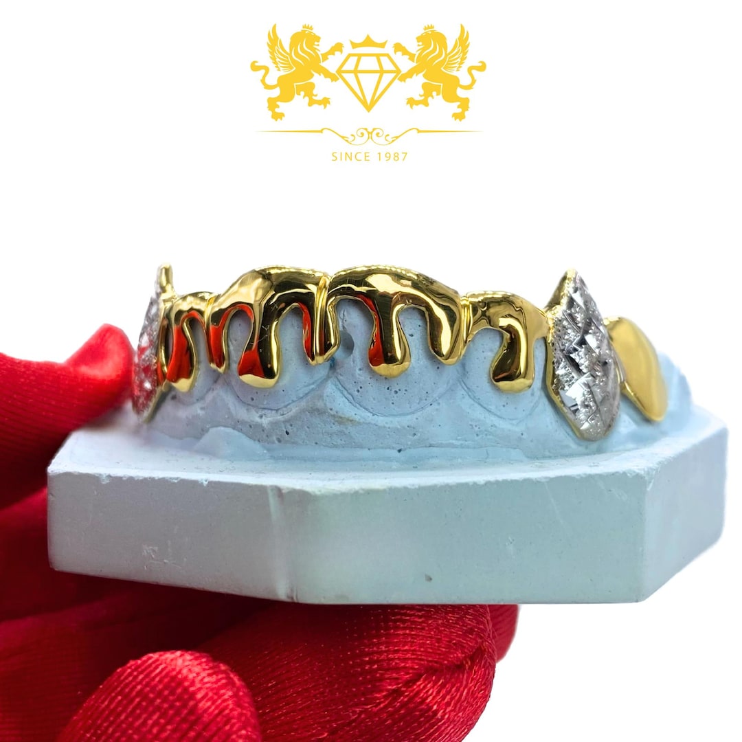 Personalized Grillz, Custom Grillz Jewelry in Houston, Grillz Fit ...