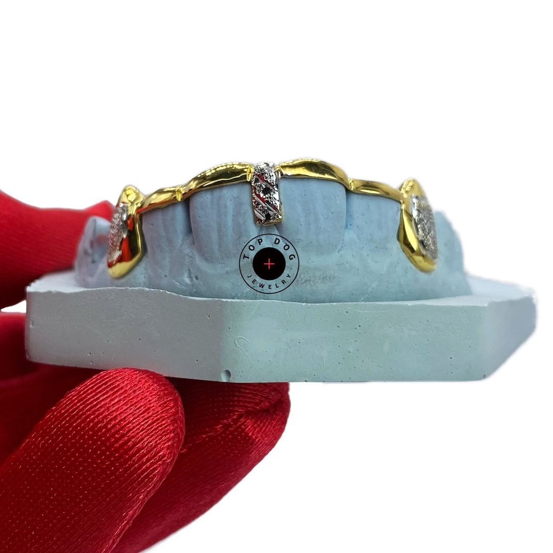 Custom Grillz, Gold Teeth, Iced Out, Diamond Grillz, Handmade, Perfect ...
