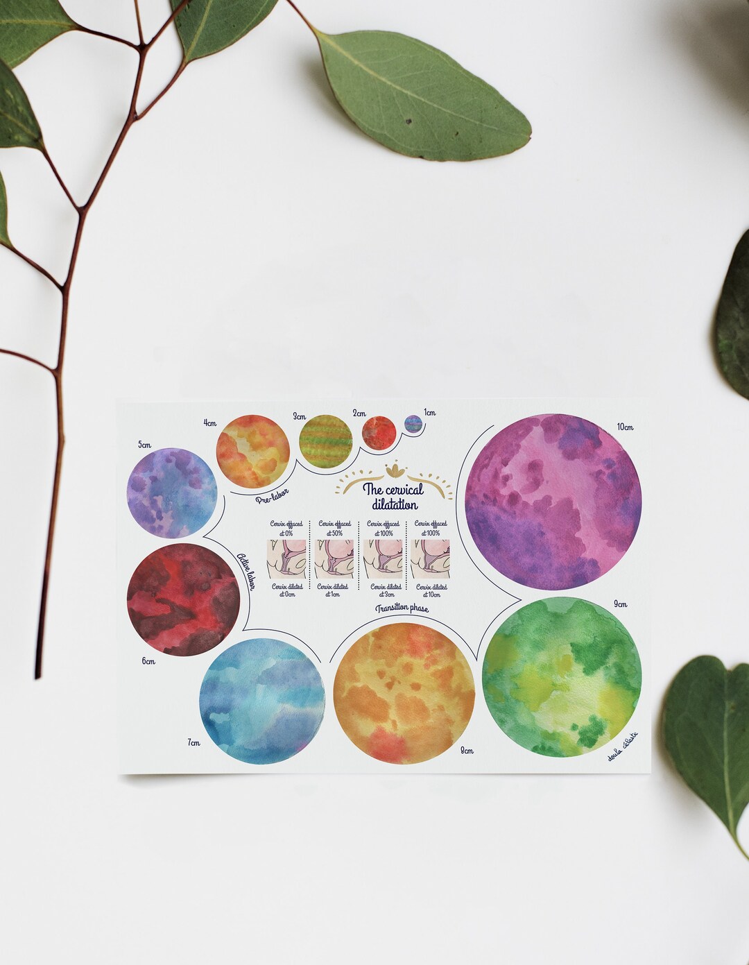 Poster - the Cervical Dilatation - Etsy