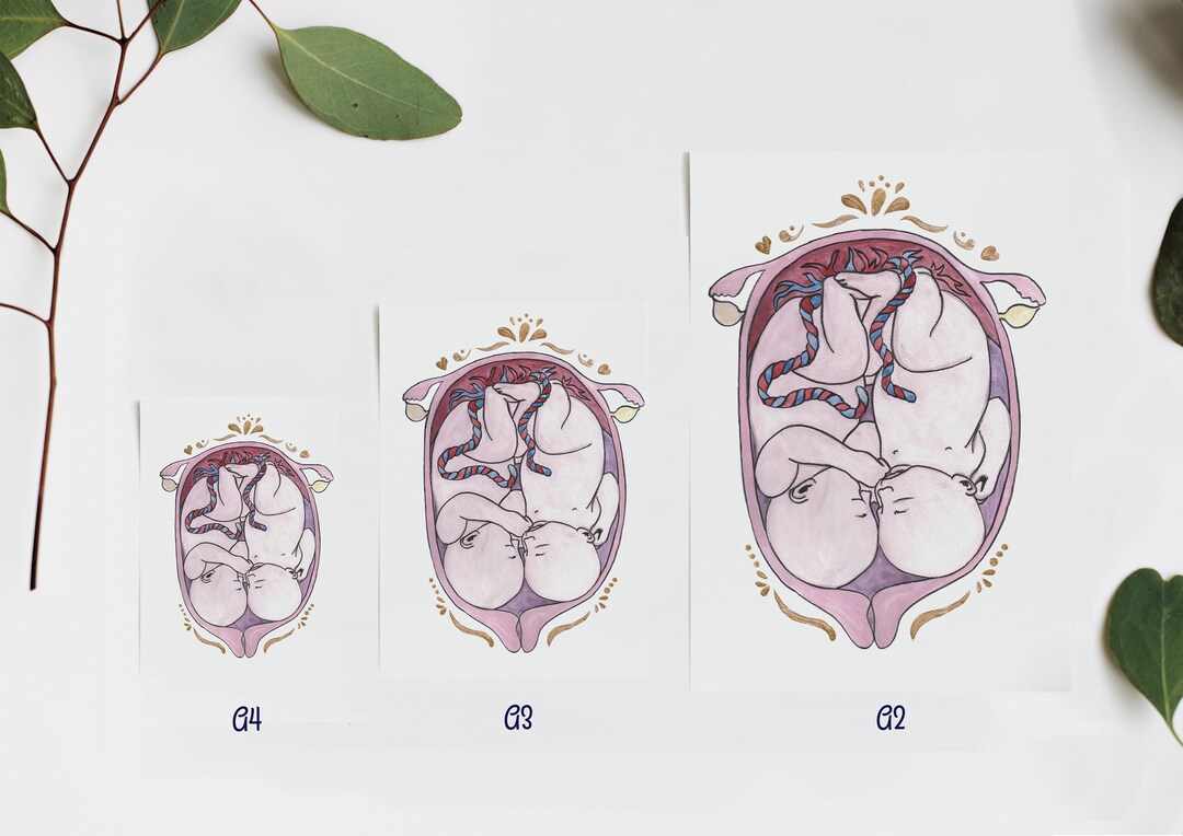 POSTER MAT Gemelos en útero/ póster acuarela/ A4 A3 A2 - Etsy España