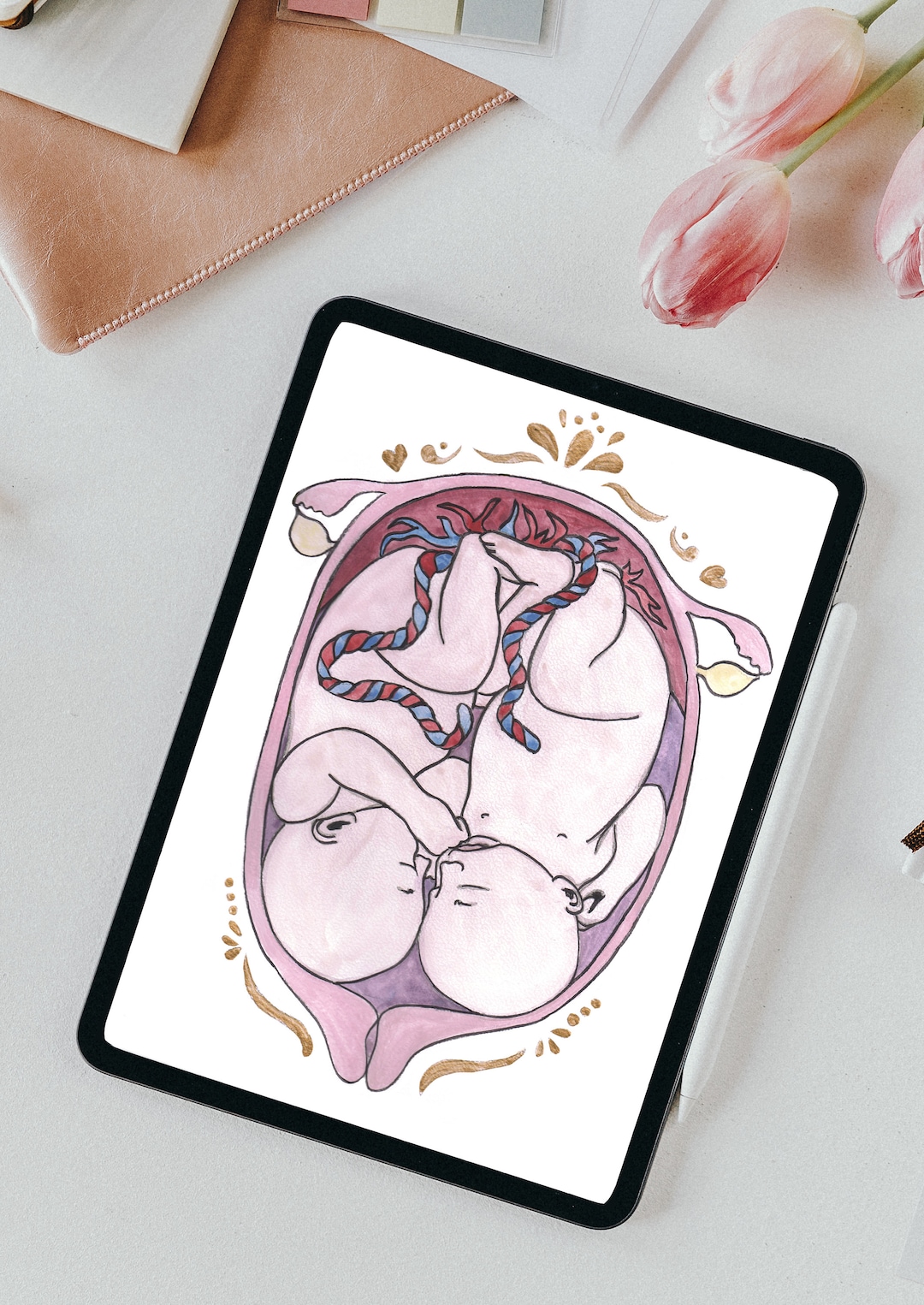 Twins Womb Digital Illustration - Etsy