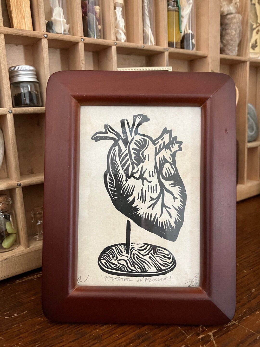 Anatomical Heart Block Print, Limited-edition Original Art Unframed ...