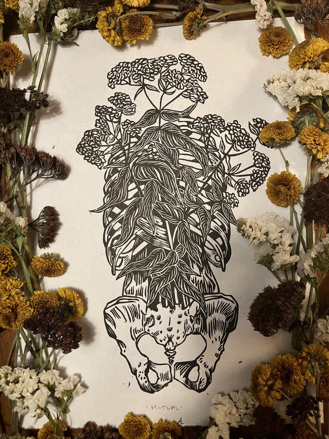 Mutual Anatomical Pelvis Block Print, Limited-edition Original Art ...