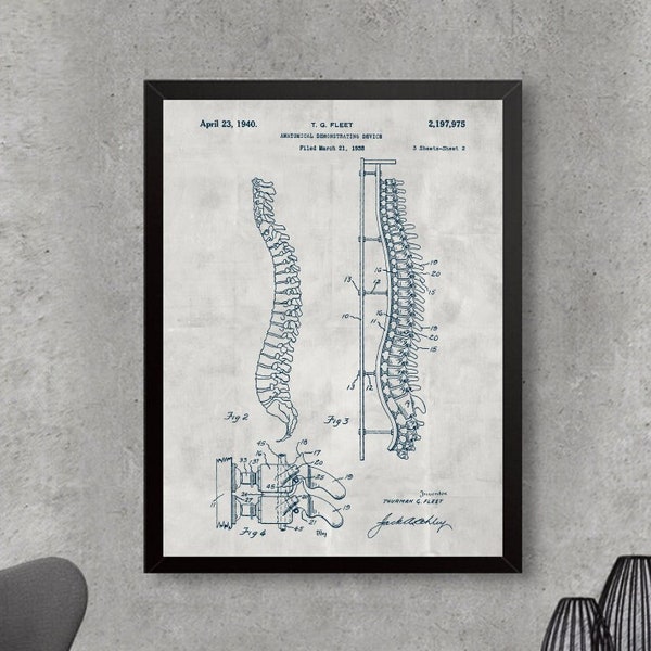 Spinal Cord Anatomy Poster - Etsy