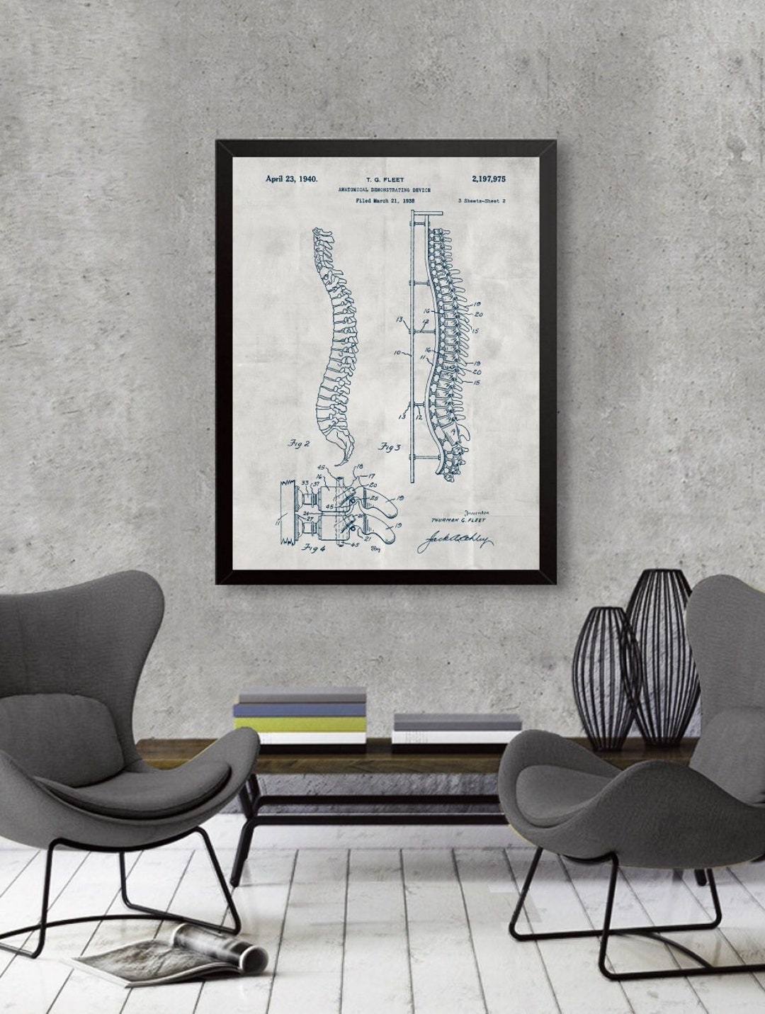 SPINAL CORD Patent Poster, Vertebral Spine ANATOMY Patent Art Print ...