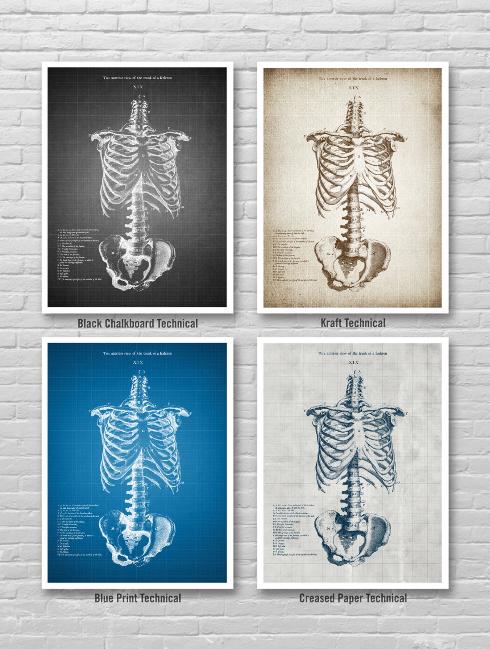 Anatomy Set of 3 Posters, Bones of the Trunk Poster, Spine Drawing Art ...