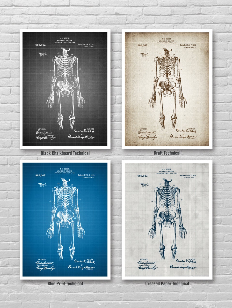 MEDICAL Patent Set of 5 Prints, Vintage Medical Instrument Patents ...