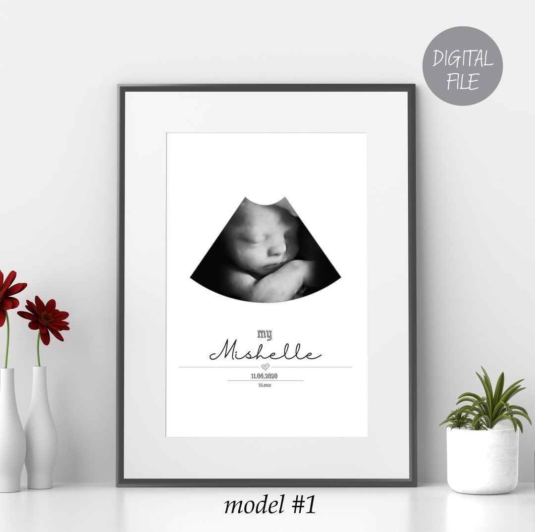 Personalized Baby Poster, Ultrasonic Image, Fetal Ultrasound Picture ...