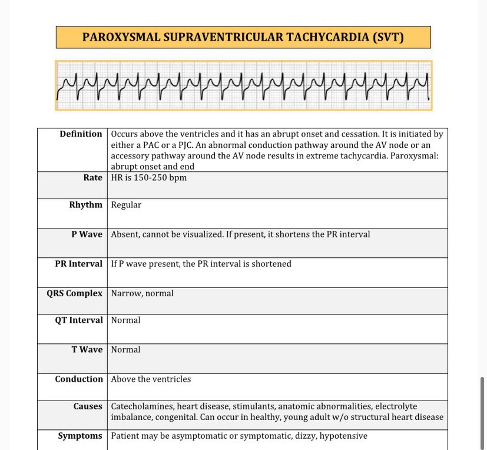 Nursing Cardiac Dysrhythmias Cheat Sheet
