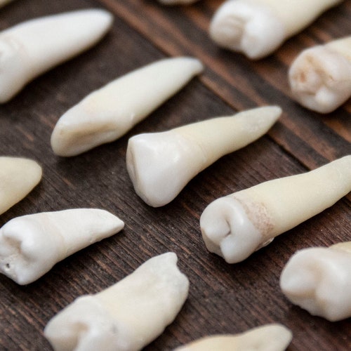 Real Human Teeth Human Pre Molars and Assorted Tooth - Etsy