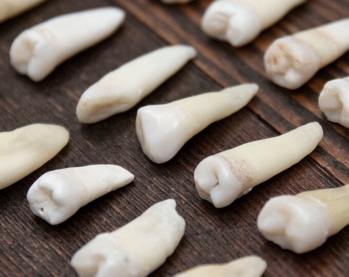 Real Human Teeth Human Pre Molars and Assorted Tooth Specimen for ...