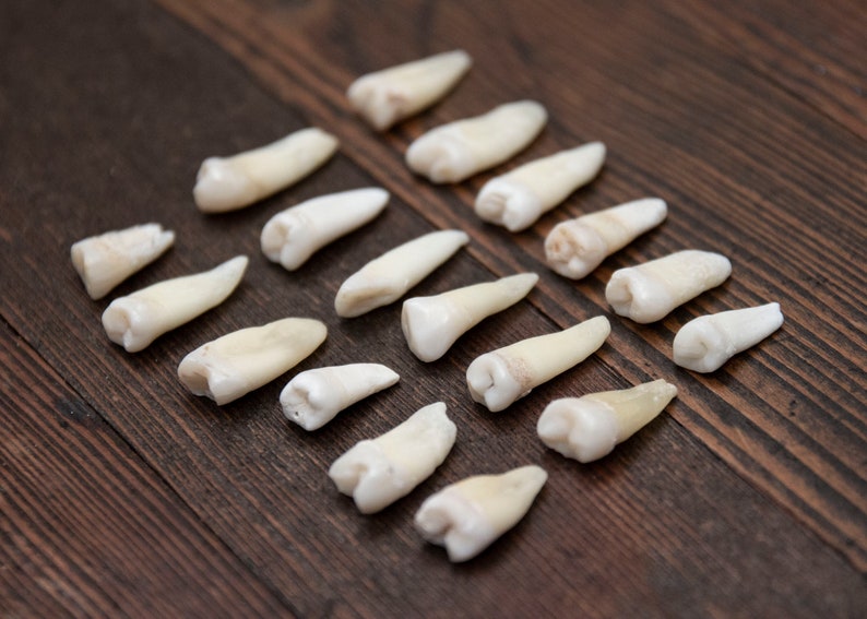 Real Human Teeth Human Pre Molars and Assorted Tooth - Etsy