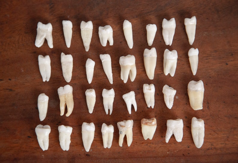 Real Human Teeth Human Molars for Oddity Display or Jewelry | Etsy
