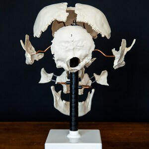 Exploded Human Skull - Beauchene Skull Model - Medical Display Model ...