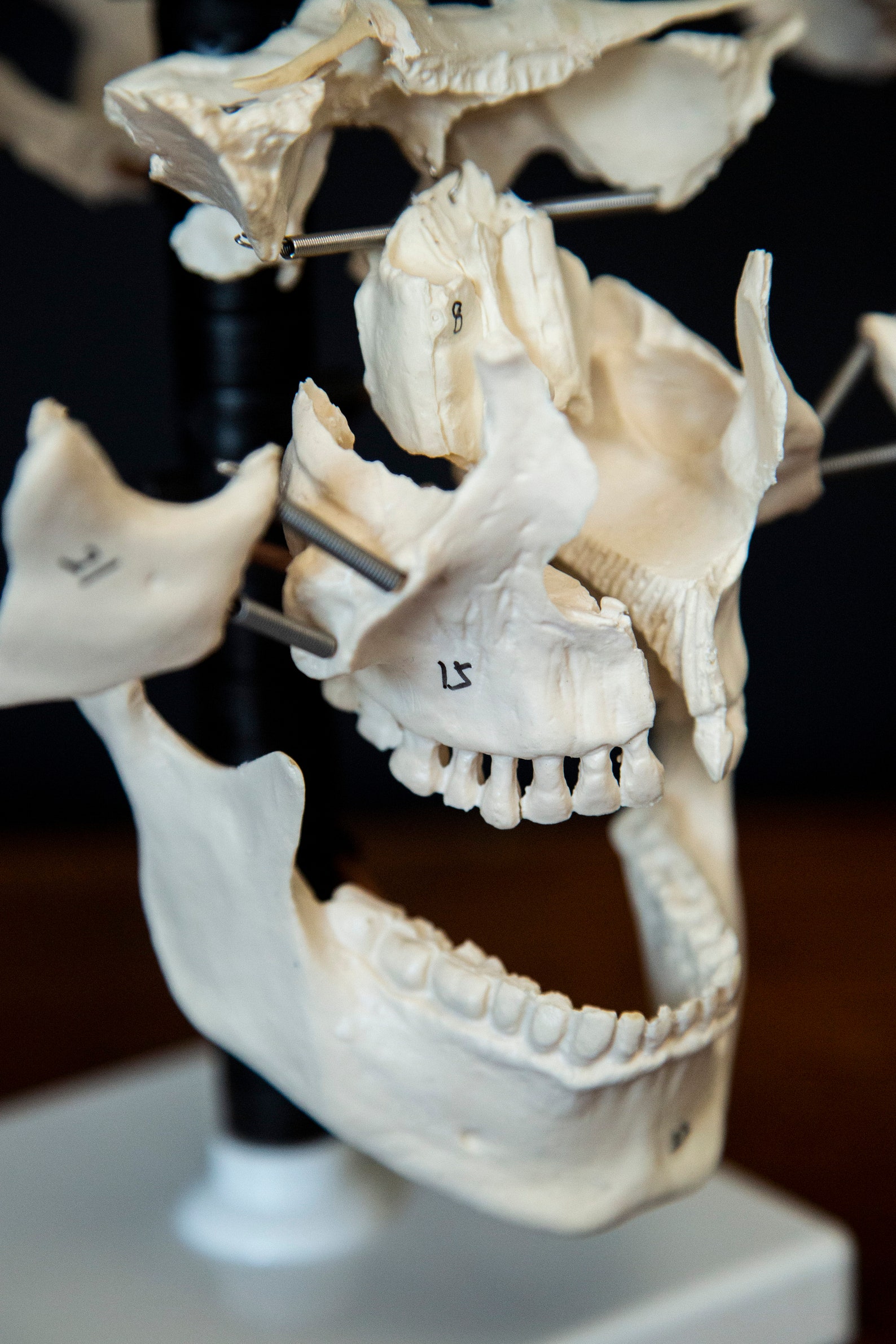 Exploded Human Skull Beauchene Skull Model Medical Display - Etsy