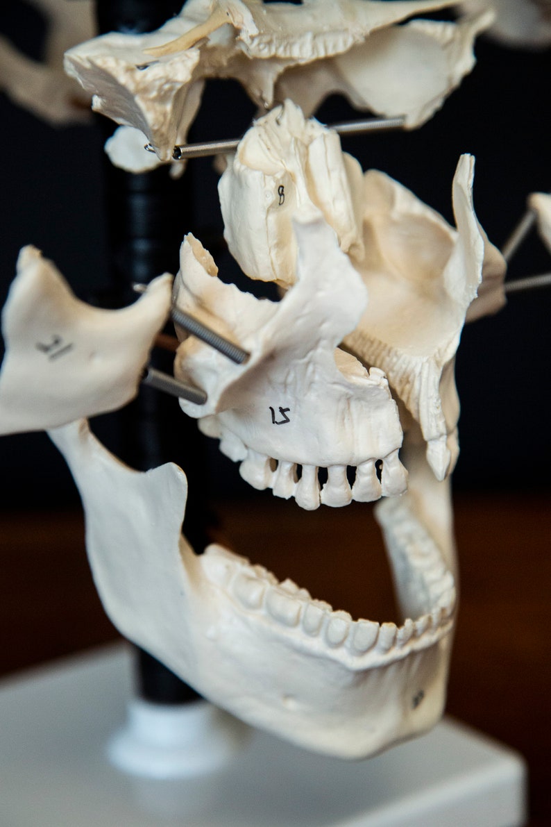 Exploded Human Skull Beauchene Skull Model Medical Display | Etsy