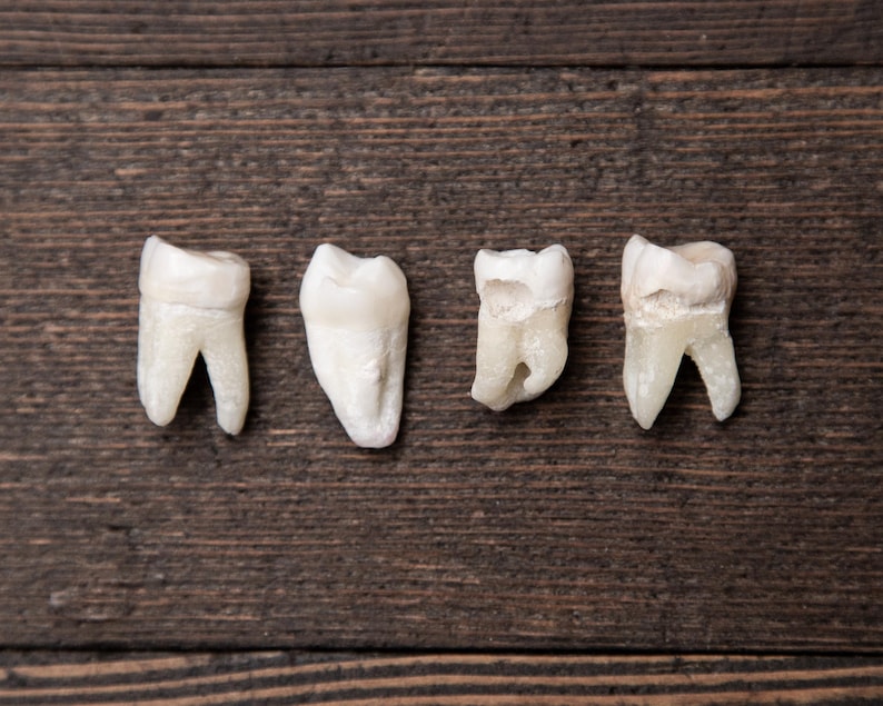 Real Human Teeth - Human Molars and Assorted Tooth Specimen for Oddity ...