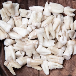 Real Human Teeth - Human Molars and Assorted Tooth Specimen for Oddity ...