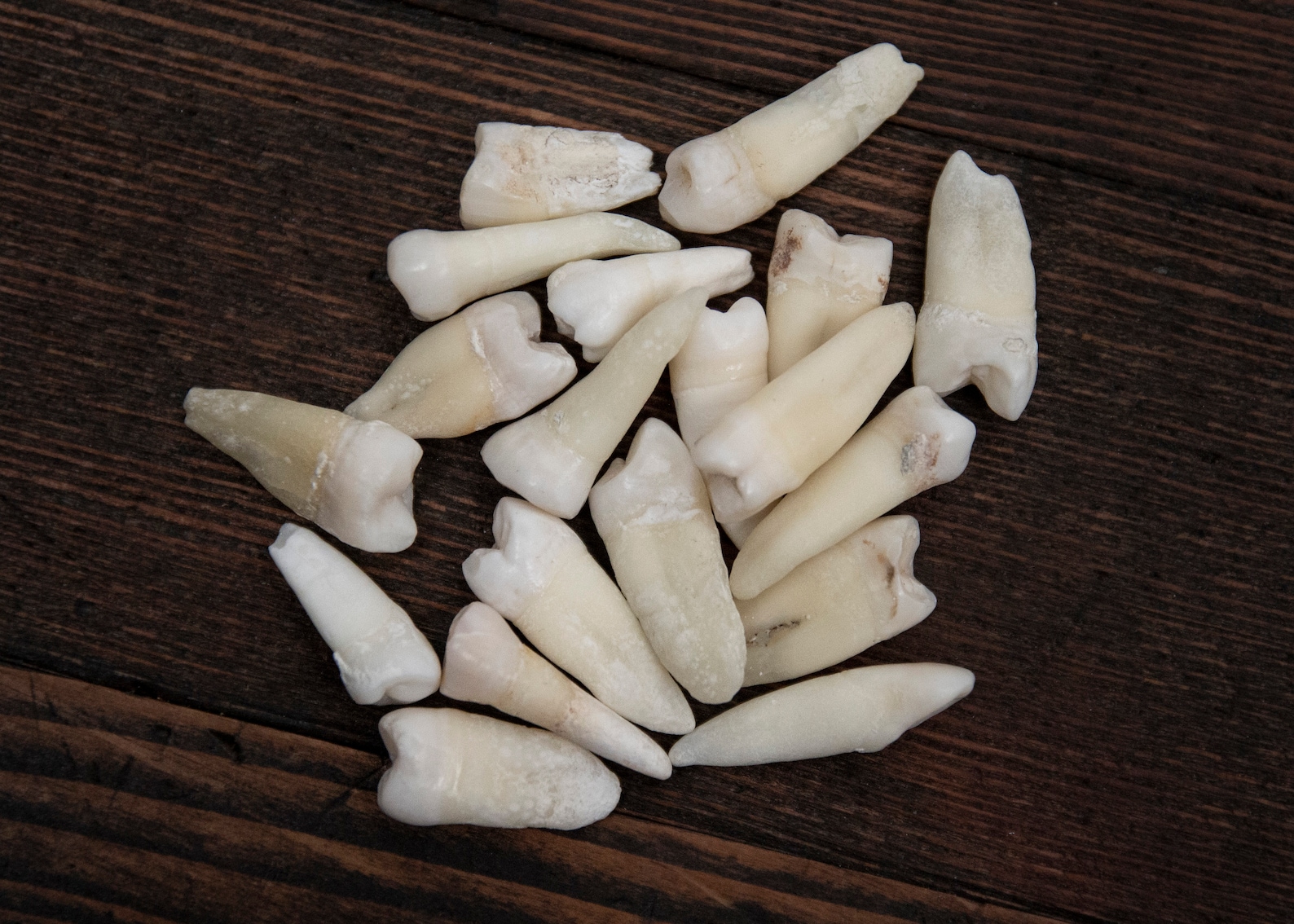 Real Human Teeth Human Pre Molars and Assorted Tooth - Etsy
