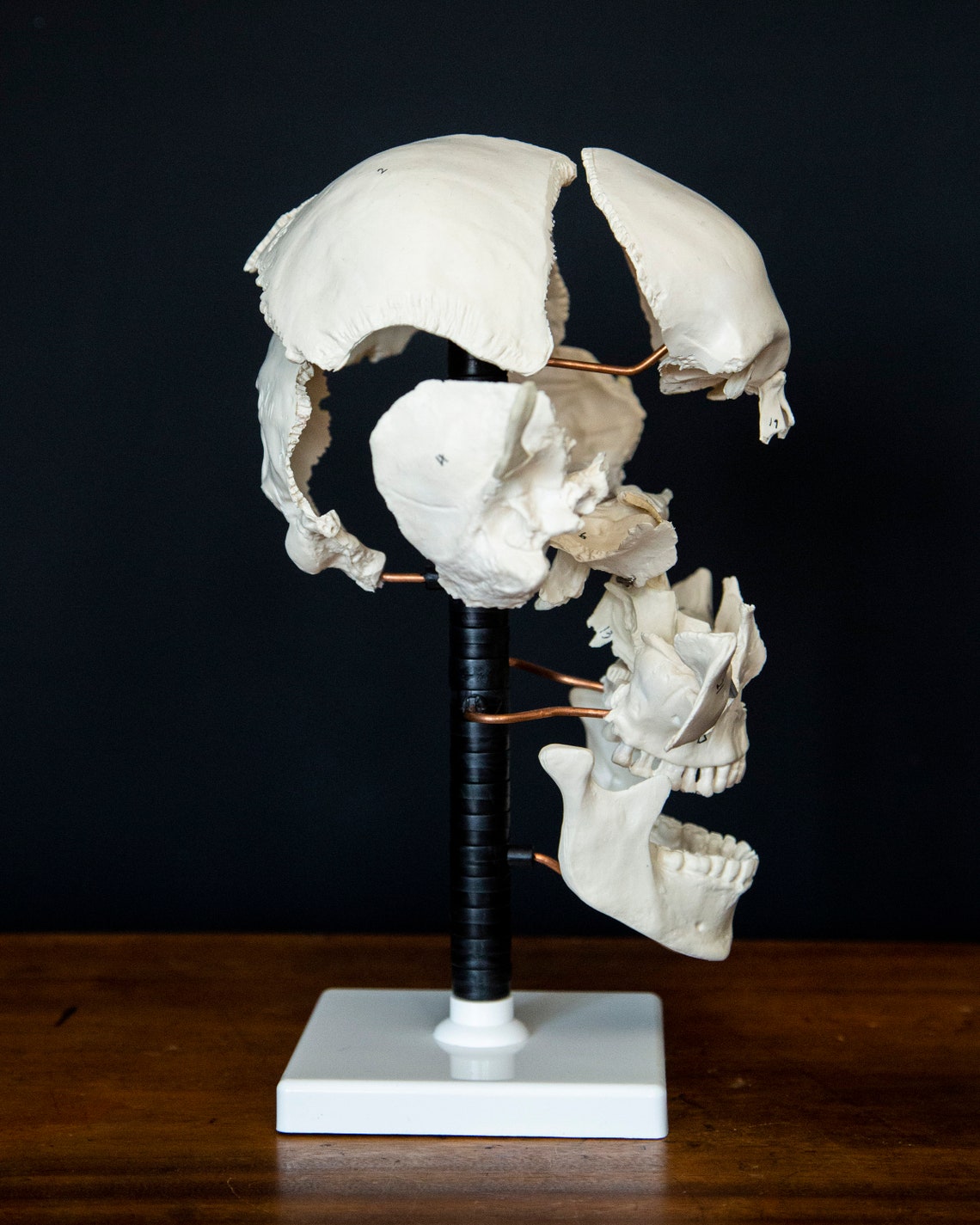 Exploded Human Skull Beauchene Skull Model Medical Display - Etsy