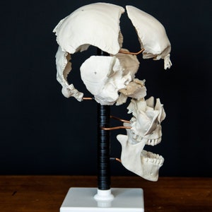 Exploded Human Skull - Beauchene Skull Model - Medical Display Model ...