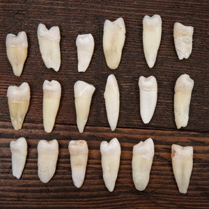 Real Human Teeth Human Pre Molars and Assorted Tooth - Etsy