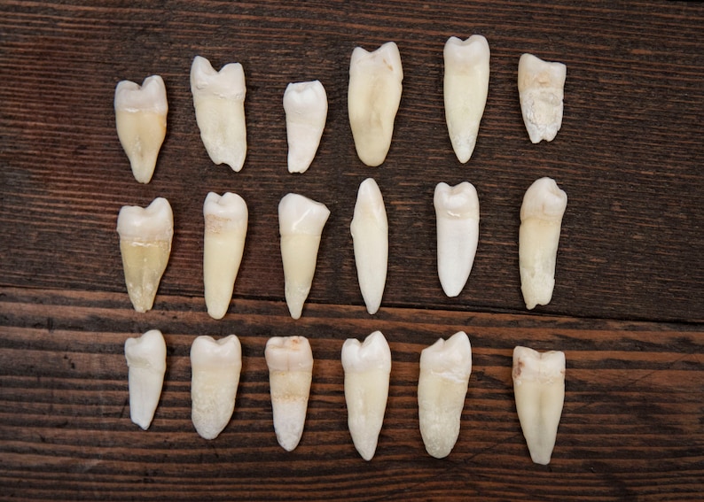 Real Human Teeth Human Pre Molars and Assorted Tooth - Etsy