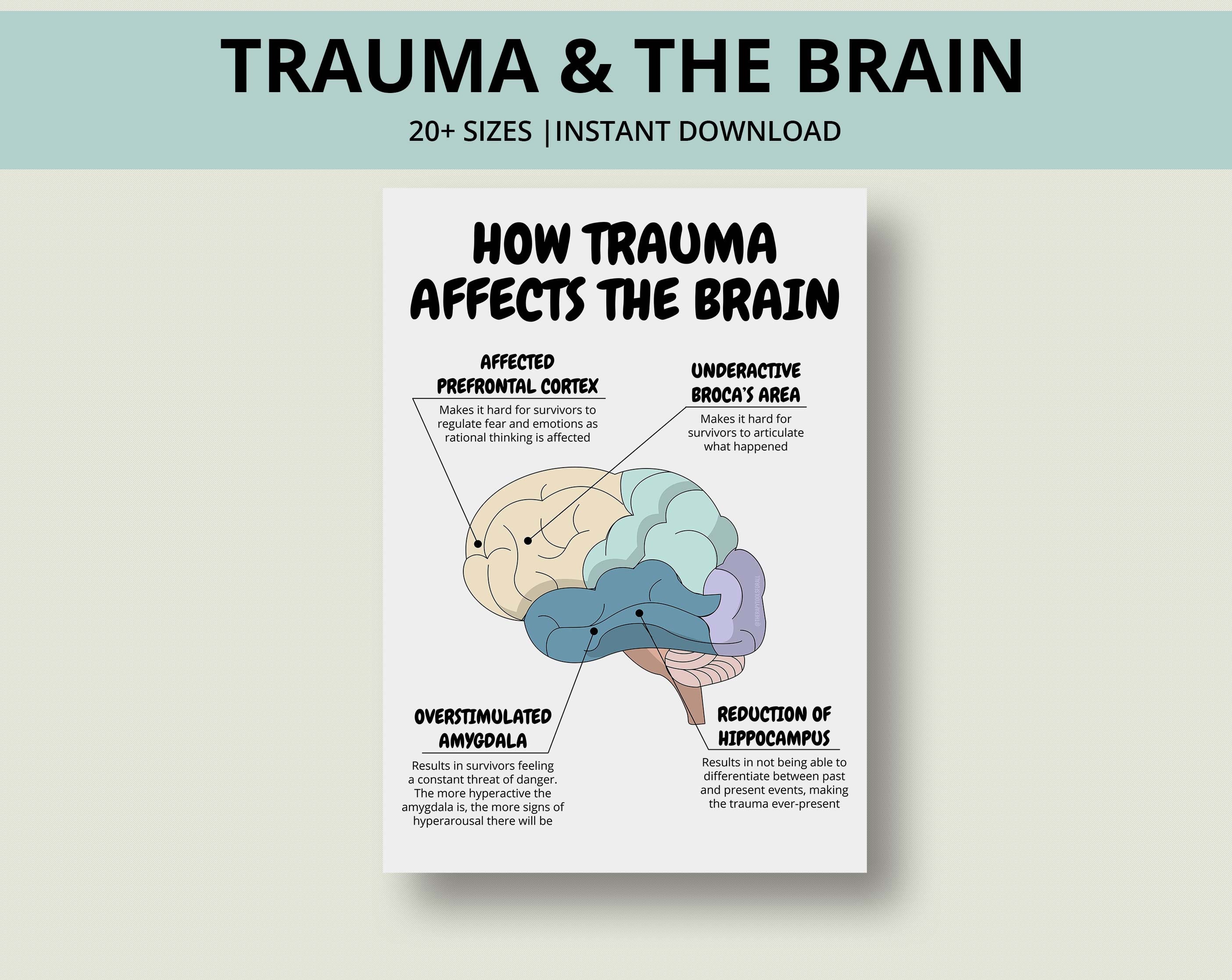 How Trauma Affects the Brain Therapist Office Decor PTSD Recovery CBT ...