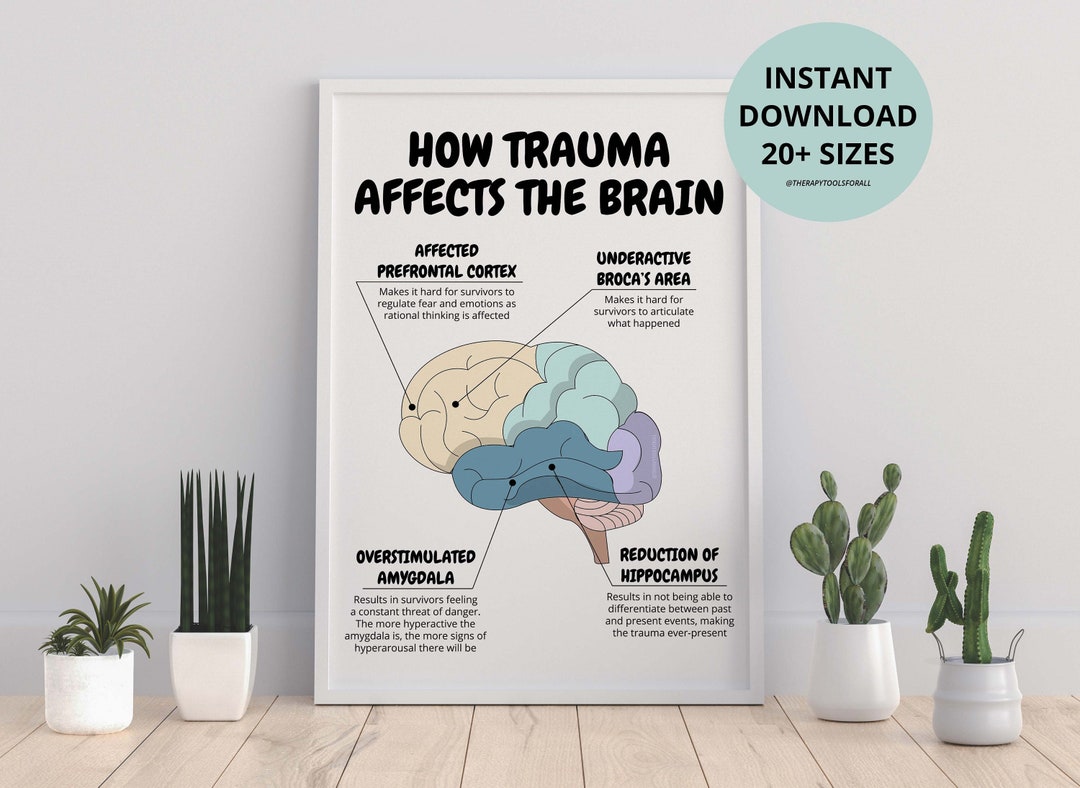 How Trauma Affects the Brain Therapist Office Decor PTSD Recovery CBT ...
