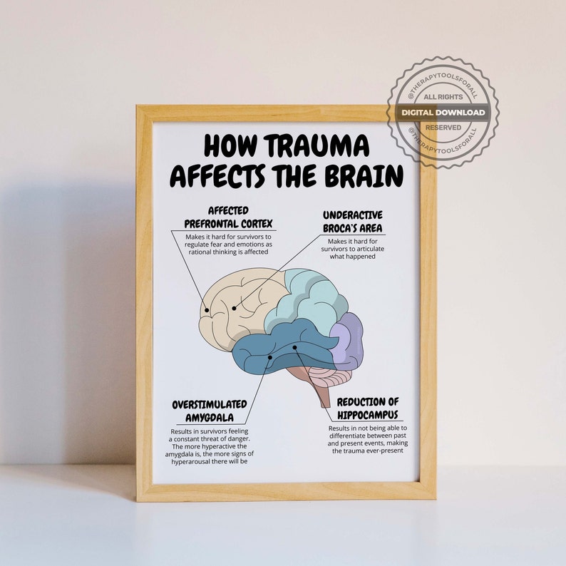 How Trauma Affects the Brain Therapist Office Decor PTSD Recovery CBT ...