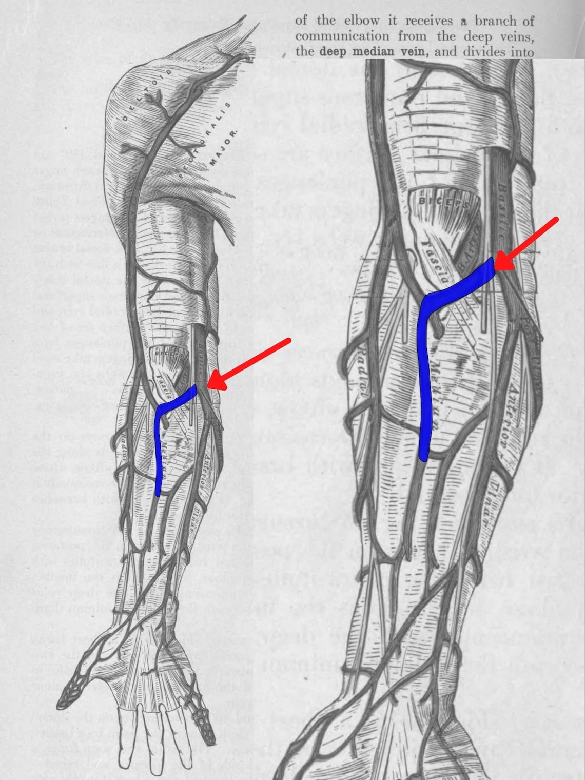 Arm Veins Flashcards Phlebotomy Notes Vein Flashcards - Etsy UK