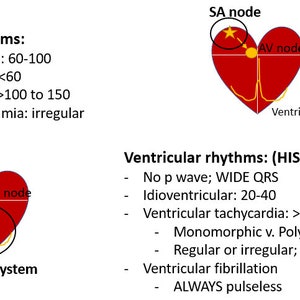 Cardiac Conduction Review - Etsy